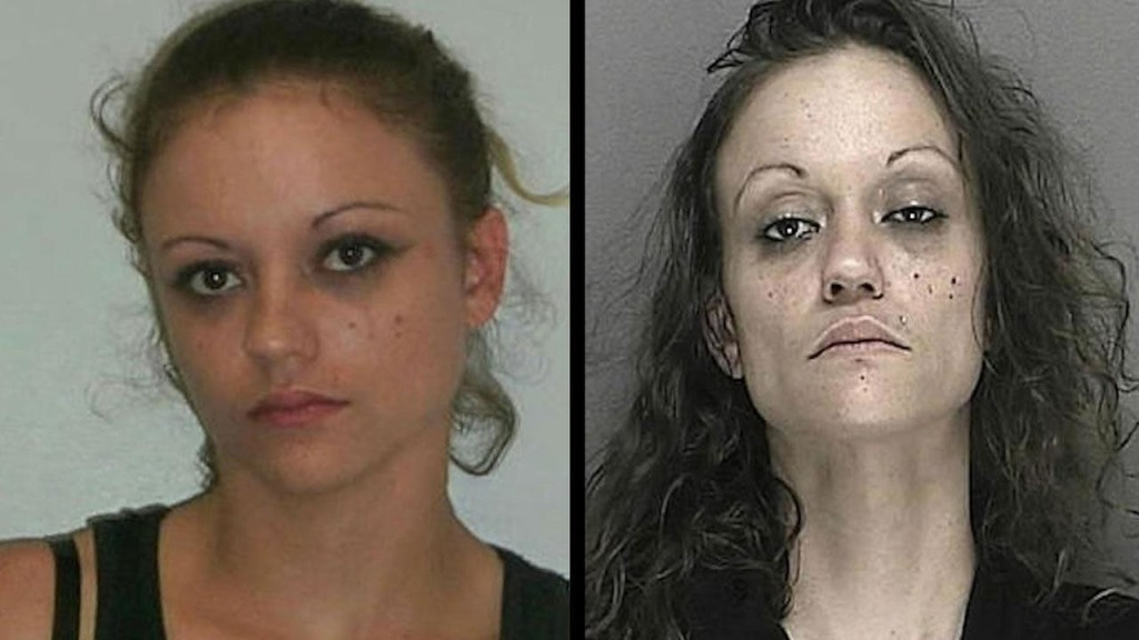 18 Disturbing Before And After Pictures Of Faces Transformed By Drug ...
