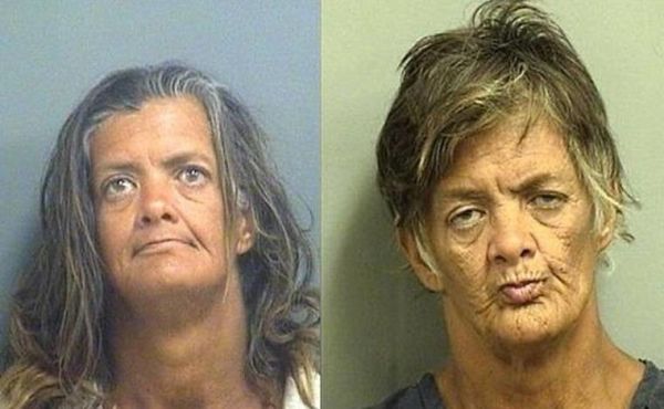 18 Disturbing Before And After Pictures Of Faces Transformed By Drug ...