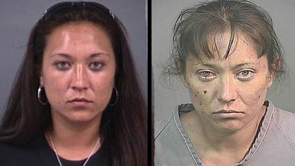 18 Disturbing Before And After Pictures Of Faces Transformed By Drug ...